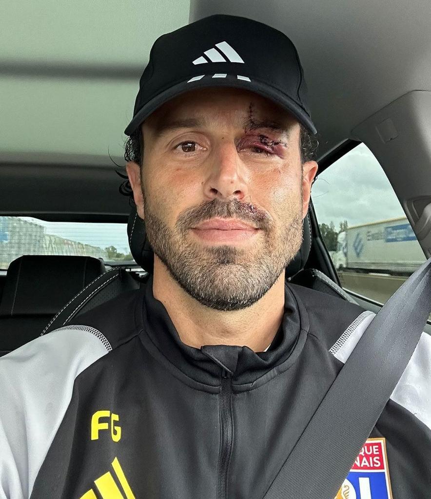 Ex rosa: 13 punti di sutura a Grosso dopo l'attacco al bus del Lione ...