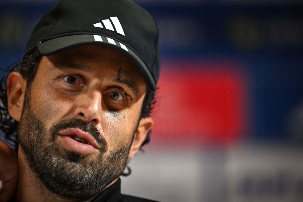 Ex rosa, Grosso torna a parlare dopo l'attacco al bus del Lione: «Ho ...